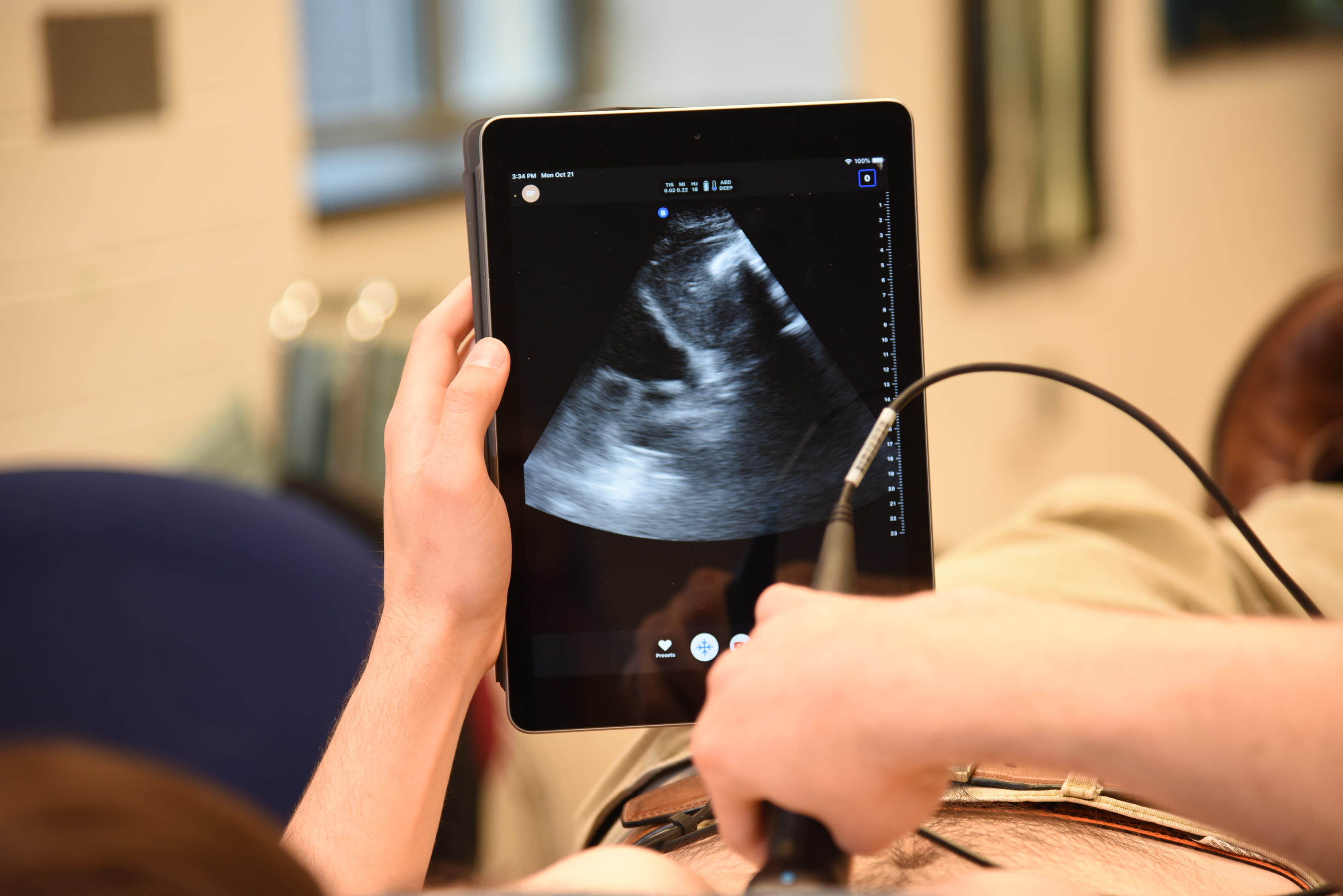 Point of Care Ultrasound | IU School of Medicine